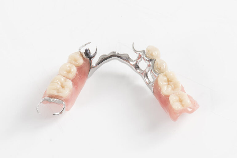 Prothèses dentaires ADJOINTES - Laboratoire DE PANNEMAECKER